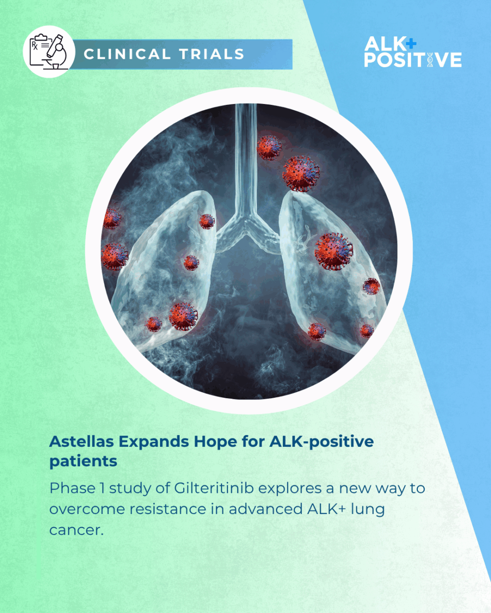 A Study of Gilteritinib in Adults with Advanced ALK-Positive Non-small ...